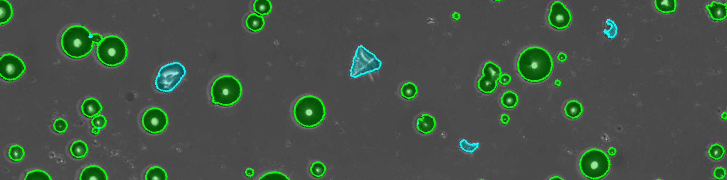 Superior Particle Analysis